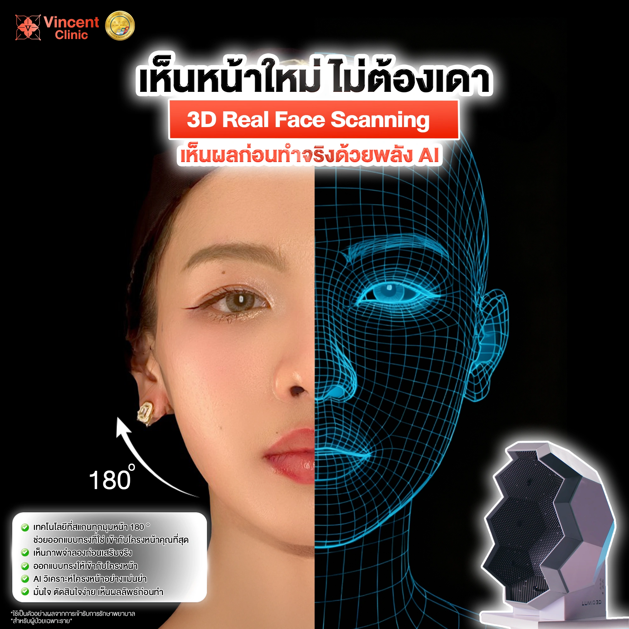 3D Real Face Scanner เทคโนโลยี AI สแกนหน้า เห็นผลลัพธ์ก่อนผ่าตัด ...